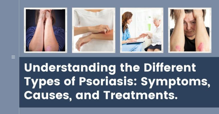 Understanding the Different Types of Psoriasis: Symptoms, Causes, and ...