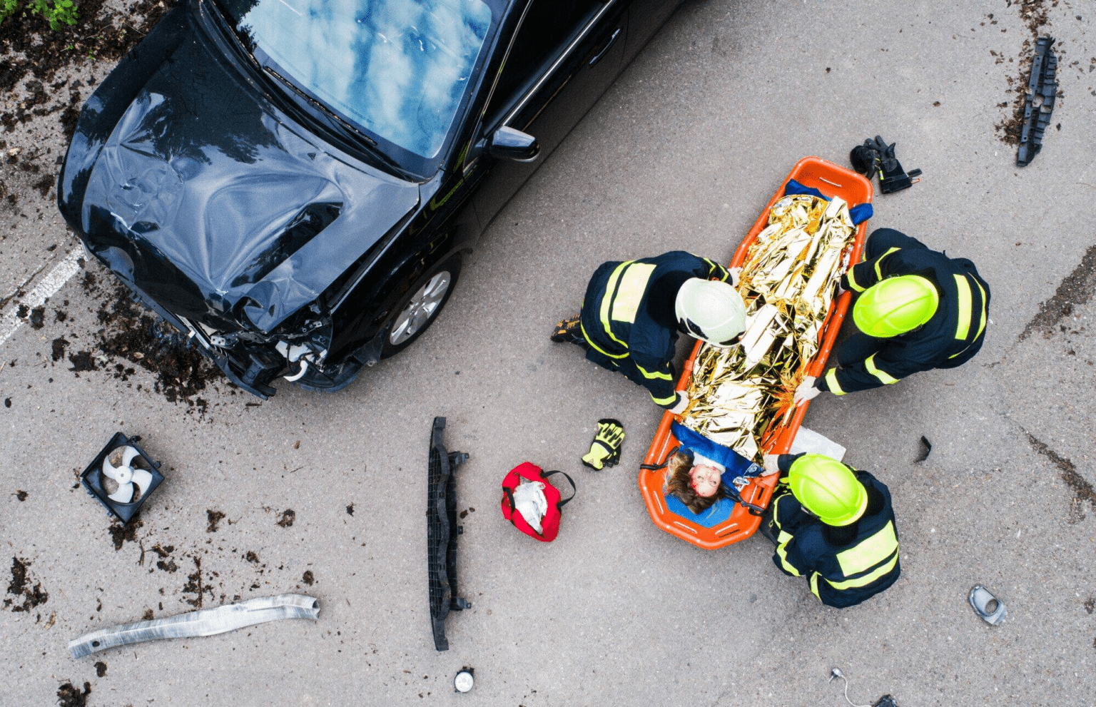 The Most Common Leg Injuries from Car Accidents - TechBullion